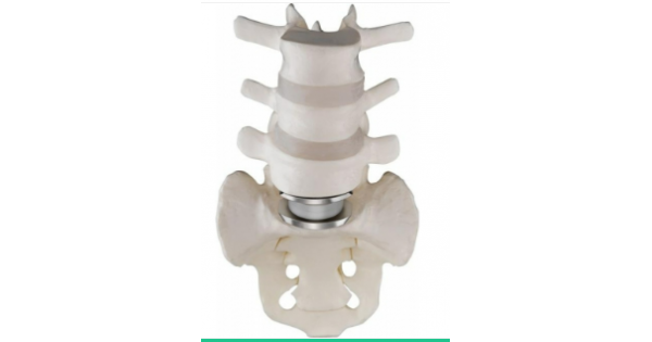 Buy Spine Surgery get price for lab equipment